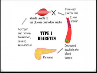 Imdad khan | PPTX | Endocrine and Metabolic Diseases | Diseases and Conditions