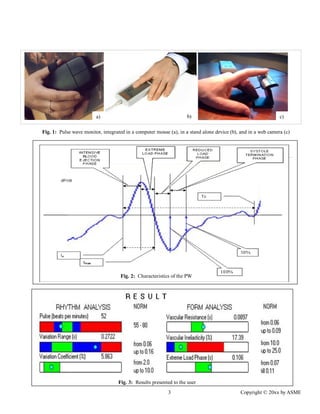 Application of pulse wave analysis in a personal health monitoring ...