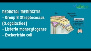 NEONATAL MENINGITIS | PDF