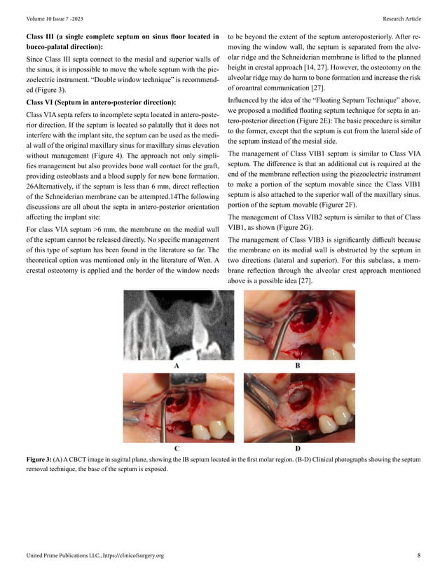 Analysis of Maxillary Sinus Septa using Cone Beam Computed Tomography: A Novel Classification ...