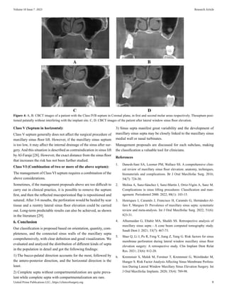 Analysis of Maxillary Sinus Septa using Cone Beam Computed Tomography ...