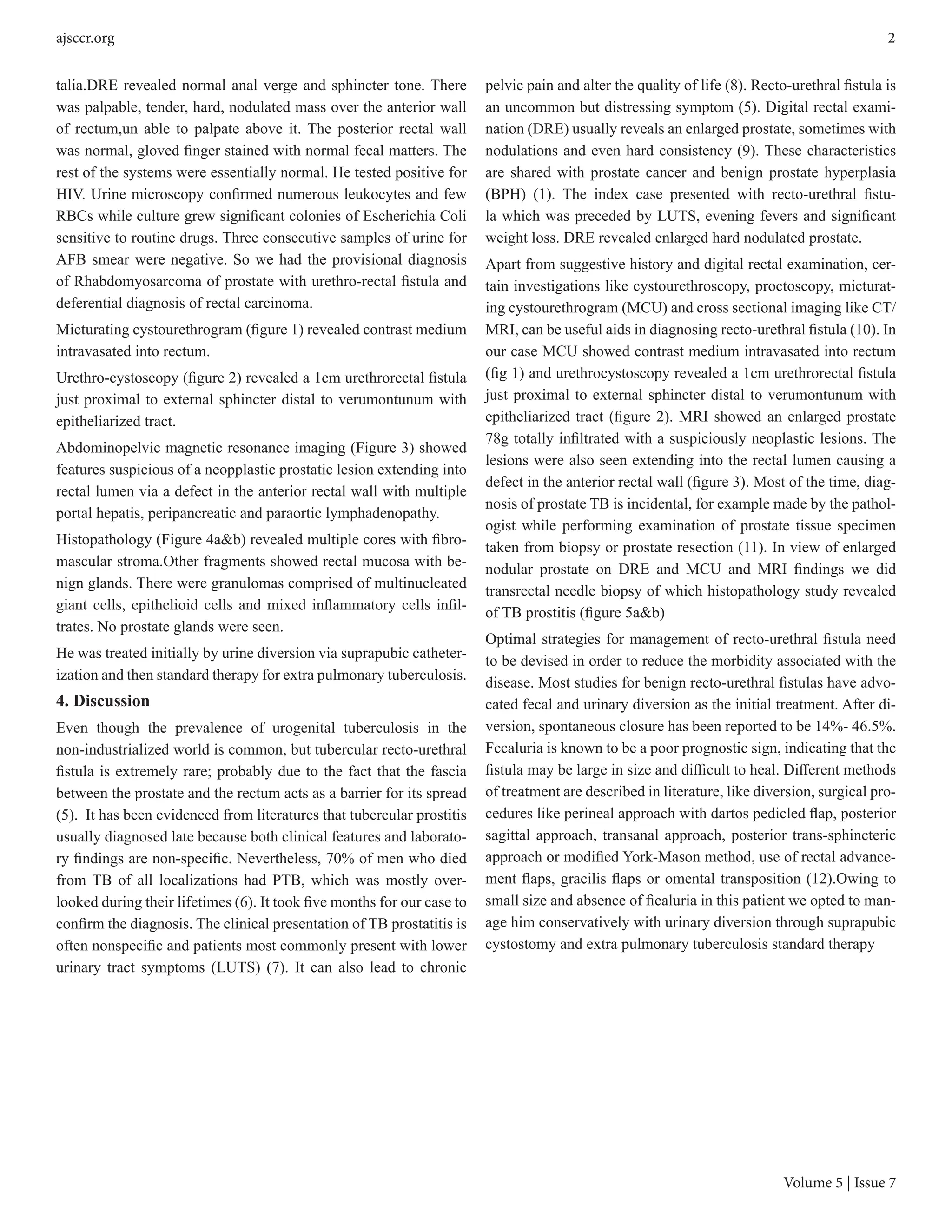 Spontaneous Tubercular Recto-Prostatic Urethral Fistula, A Rare ...
