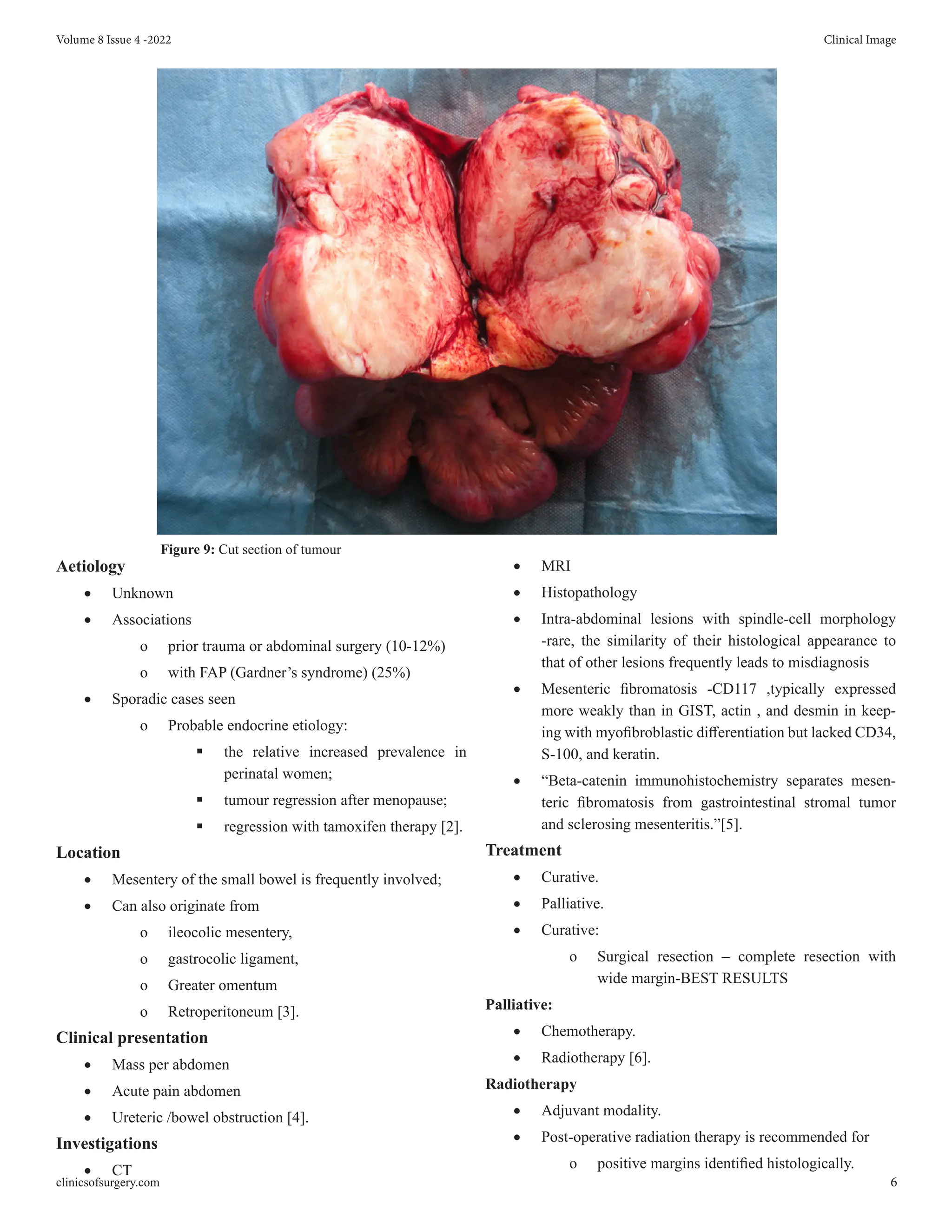 Unusual Cause of Abdominal Lump | PDF