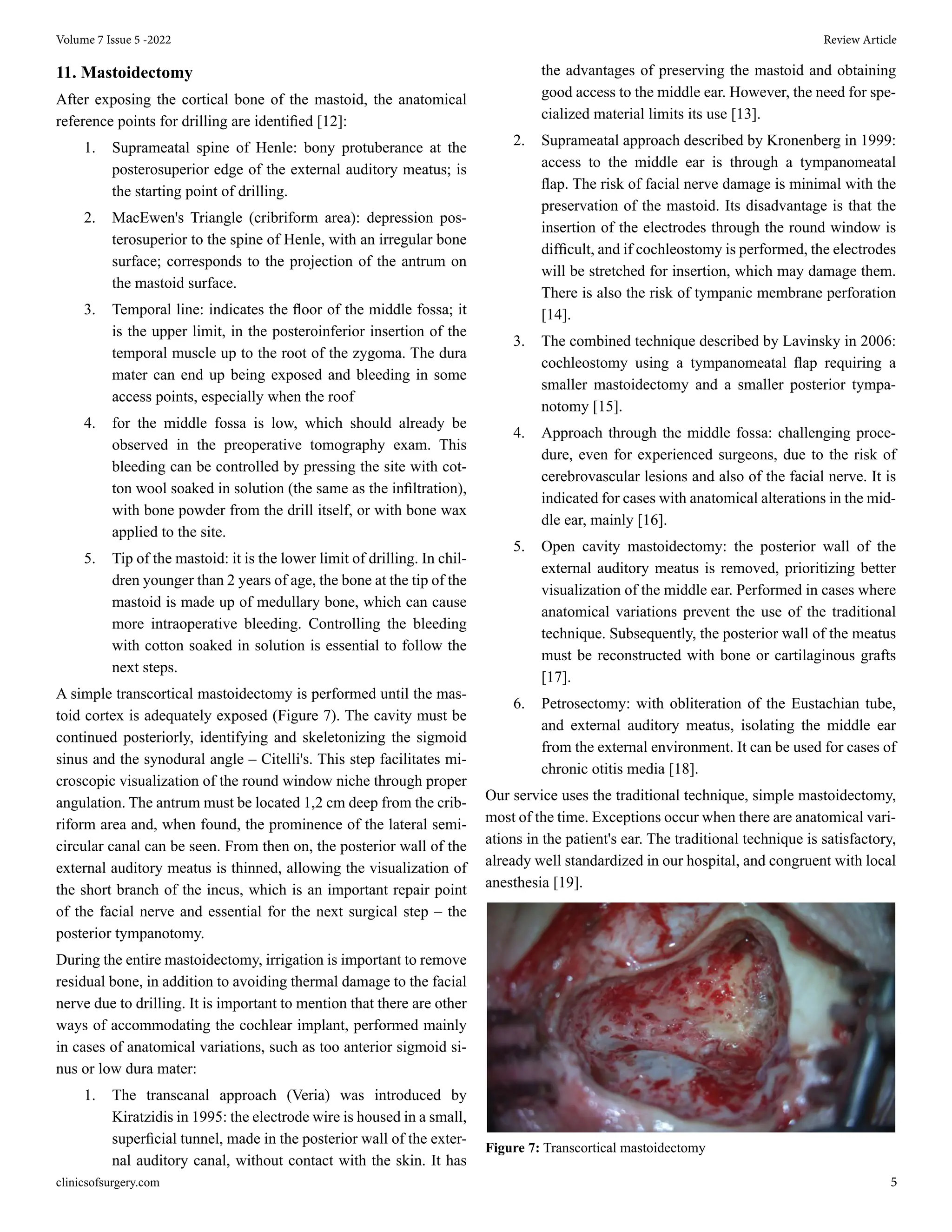 Surgical Technique of Cochlear Implantation: An Update | PDF