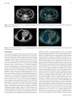 The Utility of 68Ga-DOTATOC PET/CT to Surface and Follow-up of Gastroenteropancreatic ...