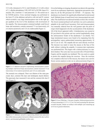 Duodenal Intussusception Secondary to Hamartomatous Polyps of the ...