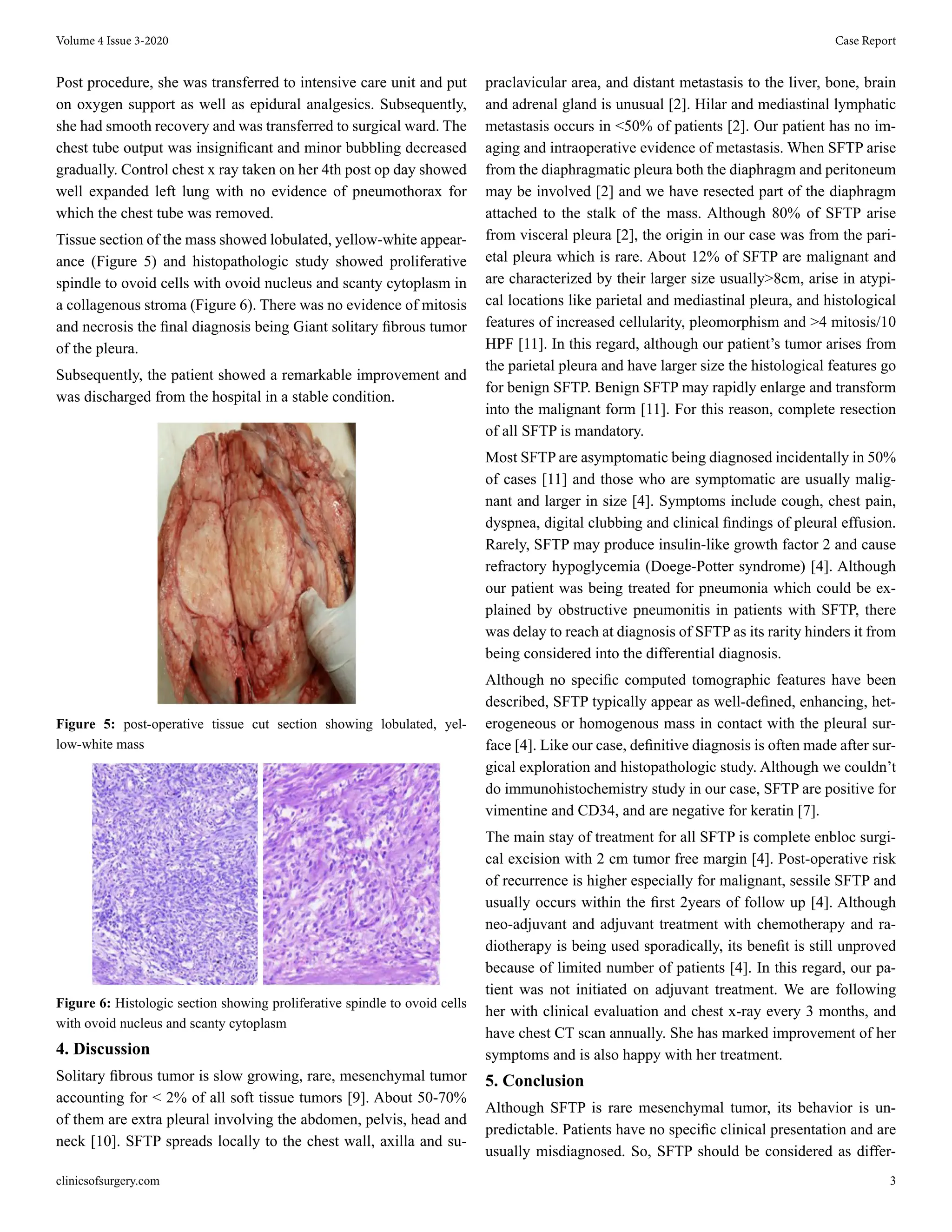Intrathoracic Giant Solitary Fibrous Tumor Case Report Pdf