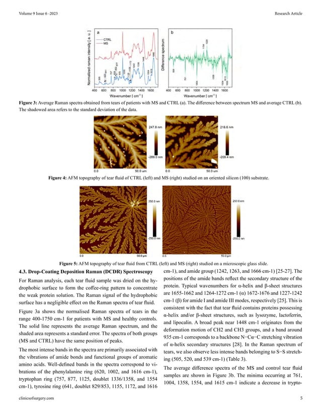Experimental Analysis of Tear Fluid and their Processing for the ...