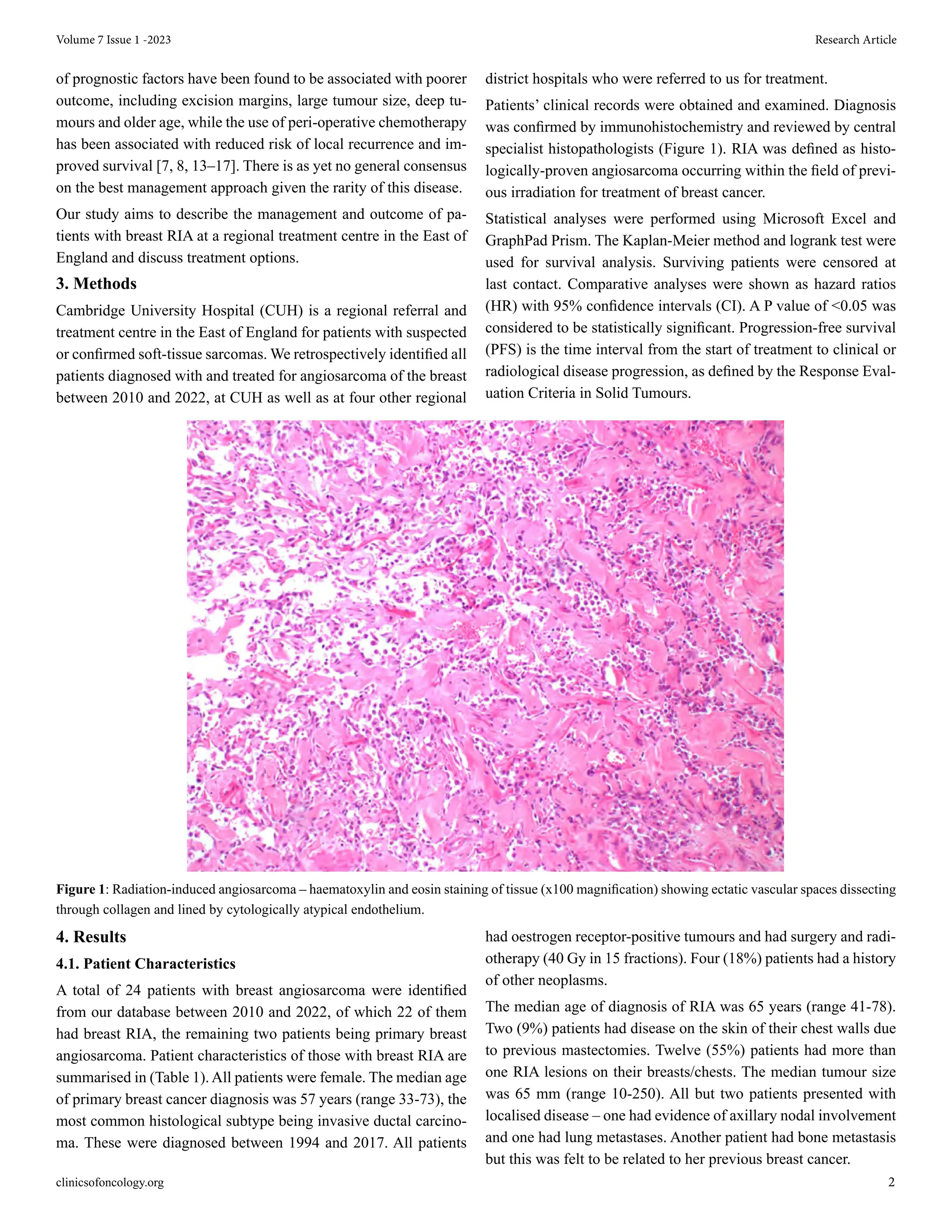 Radiation-Induced Angiosarcoma of the Breast: Retrospective Analysis at a Regional Treatment ...