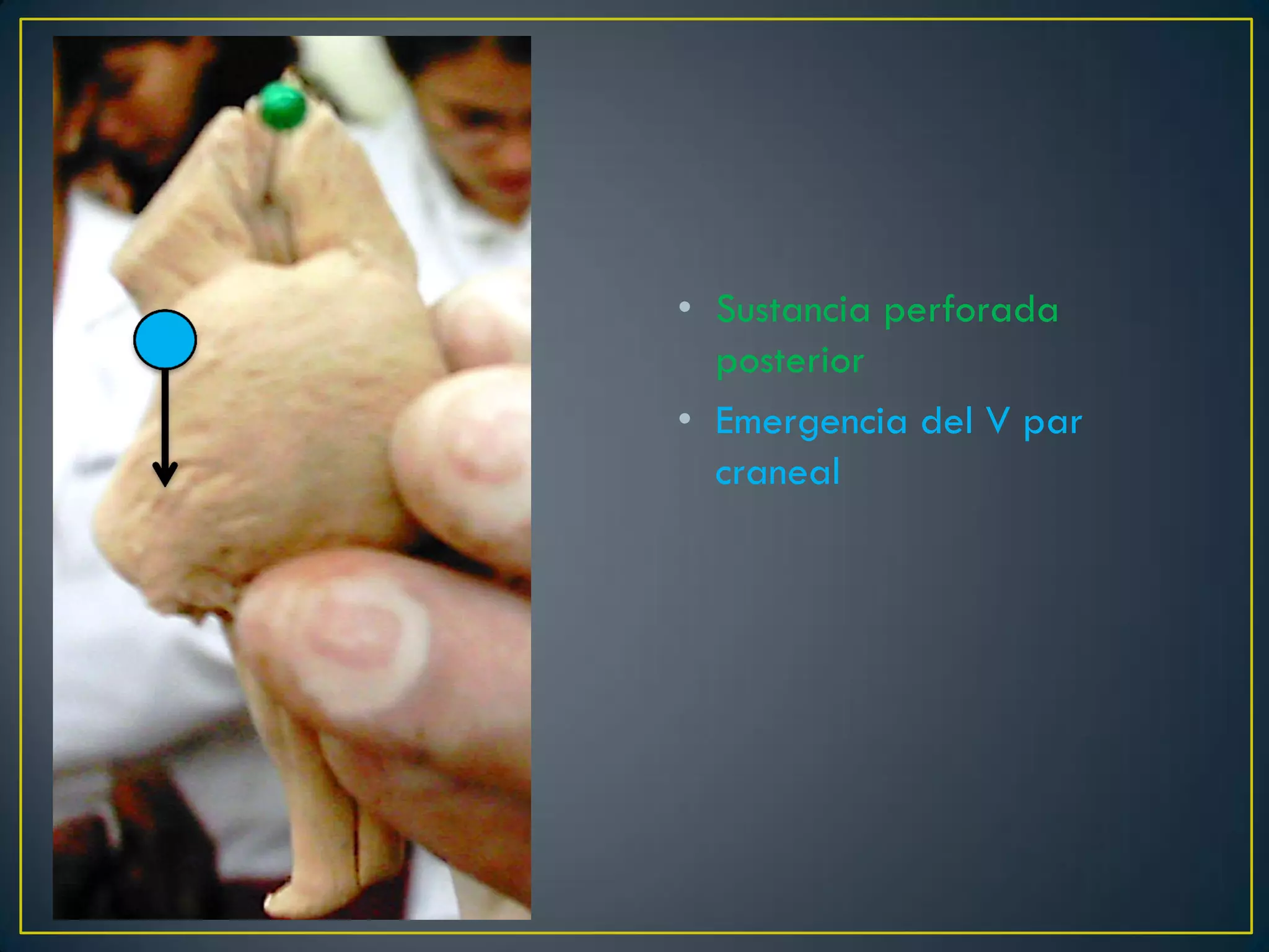 Imágenes neuroanatomícas del tronco encefálico | PPT