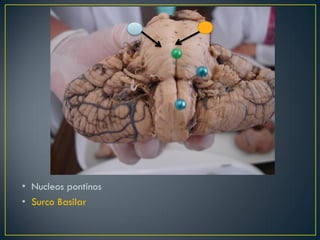 Imágenes neuroanatomícas del tronco encefálico | PDF