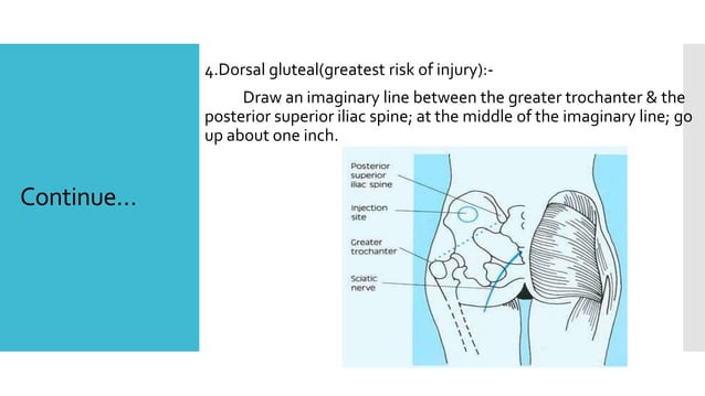 Intramuscular Injection(IM) injection | PPTX