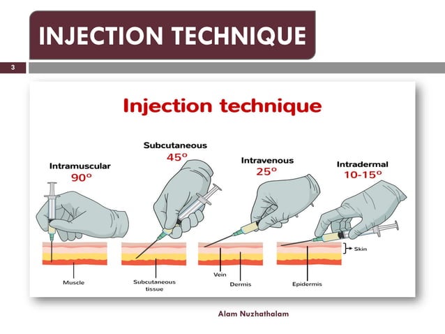 Intramuscular Injection or IM Injection | PDF