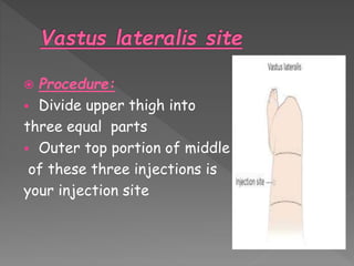 INTRAMUSCULAR INJECTIONS | PPTX