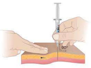 INTRAMUSCULAR INJECTIONS | PPTX