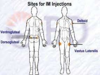 INTRAMUSCULAR INJECTIONS | PPTX