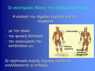 Ενδομυϊκή χορήγηση φαρμάκων | PPTX