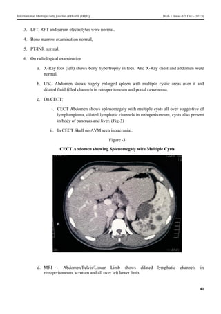 Klippel Trenaunay Weber (KTW) Syndrome with solid organ involvement ...