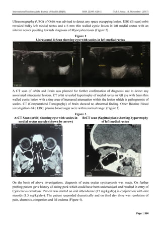 Isolated Medial Rectus Cysticercosis mimicking pre-septal cellulitis: A ...
