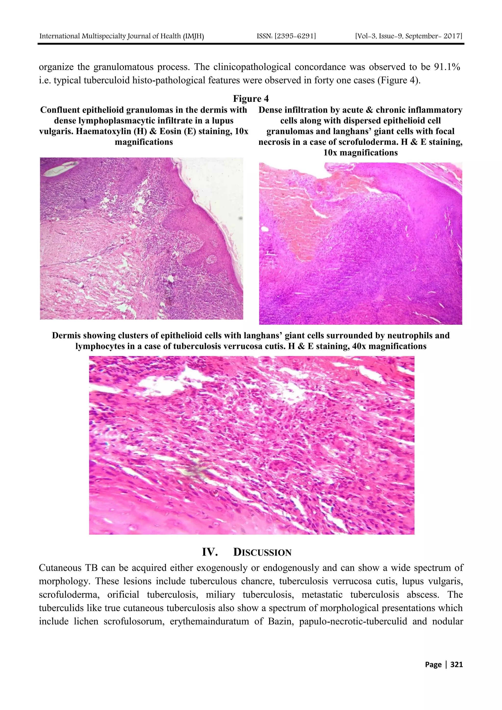 Clinico-epidemiological study of cutaneous tuberculosis in a tertiary ...
