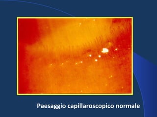 Immagini capillaroscopia. Dott. Mauro Zanocchi | PPT