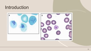 Immature platelet fraction (IPF)(Reticulated Platelets) | PPTX