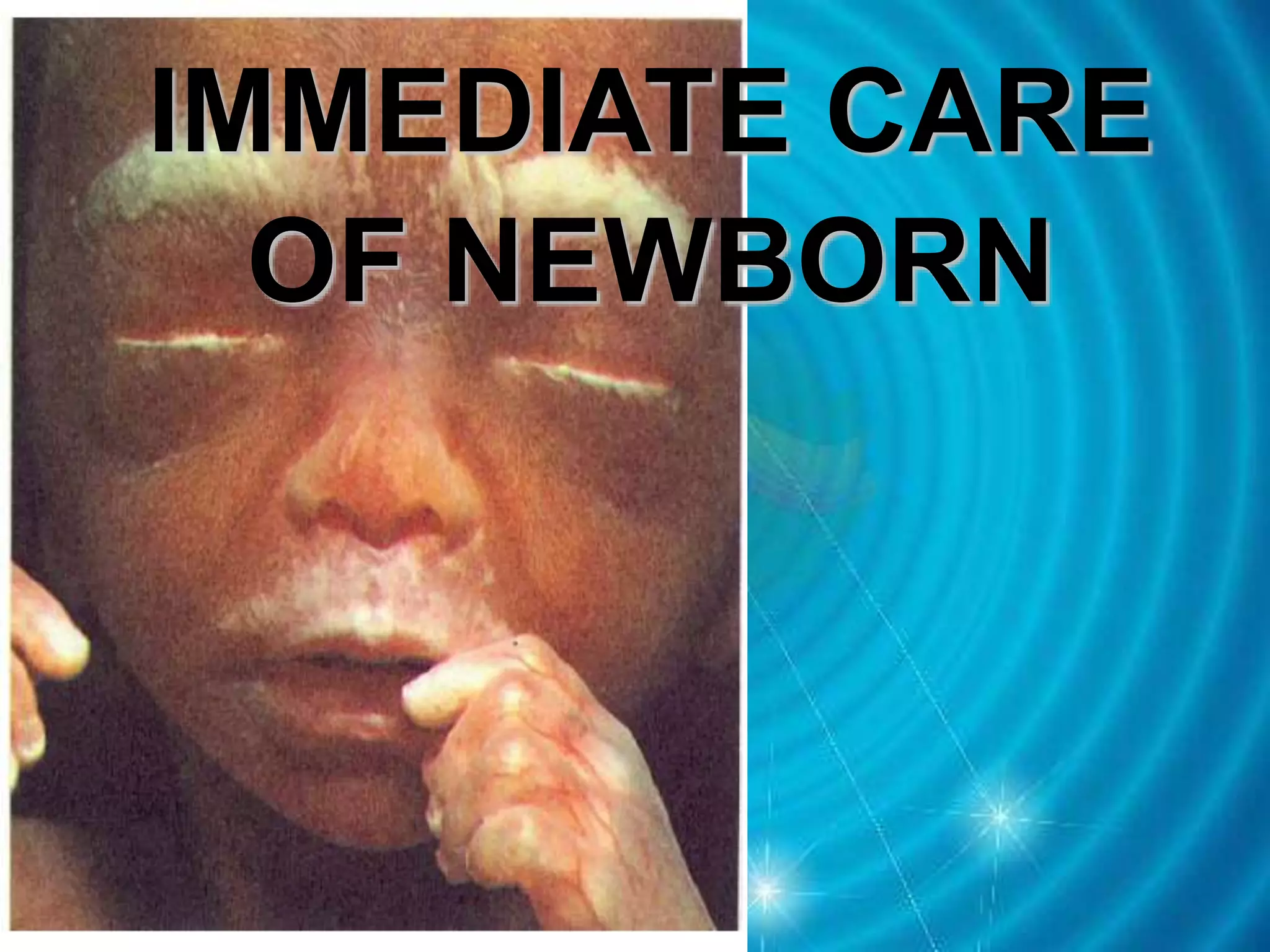 immediate-care-of-newborn.ppt