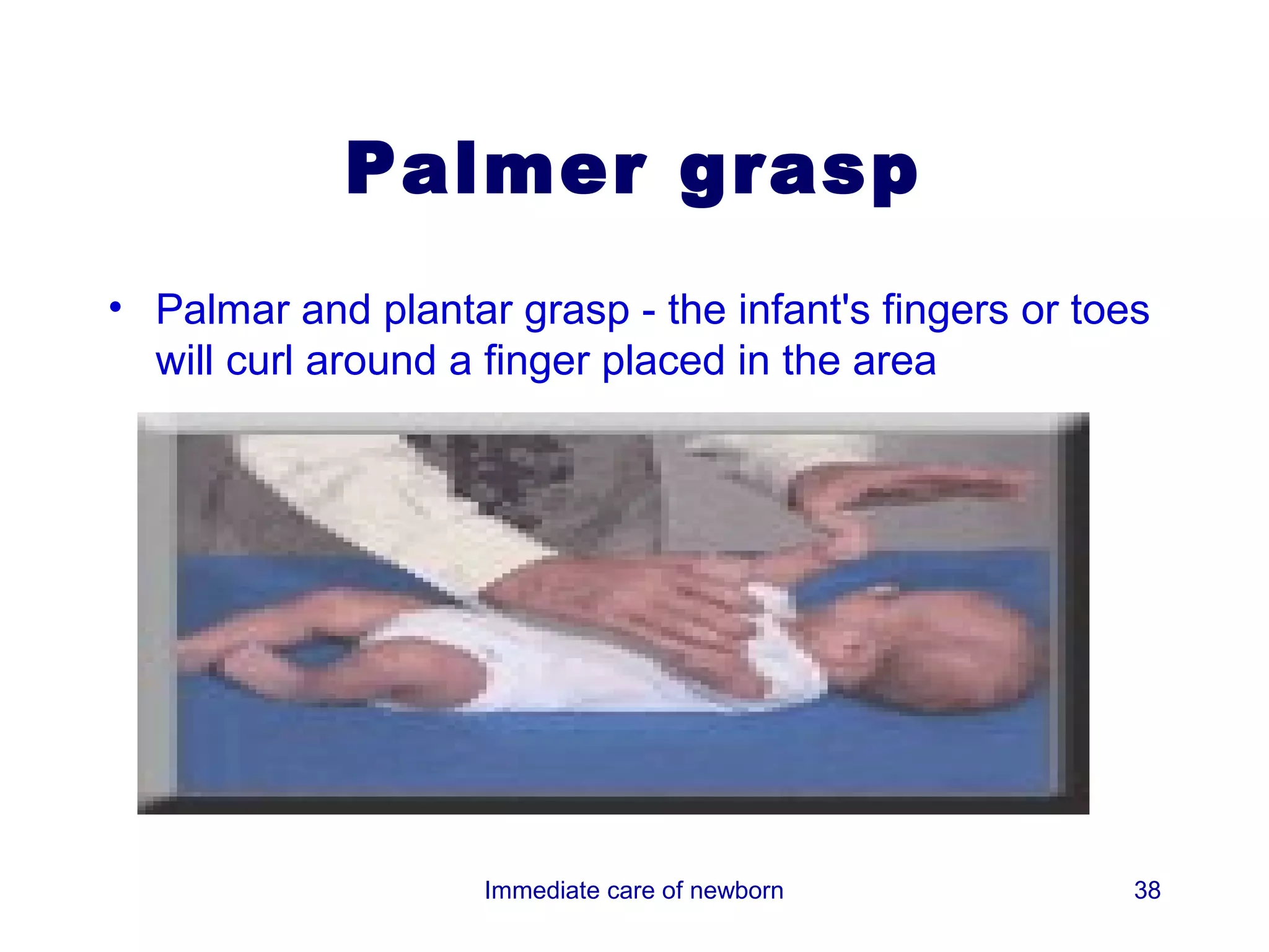 Immediate care lamiaa slide share | PPT