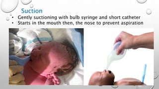 Immediate care of new born baby | PPTX