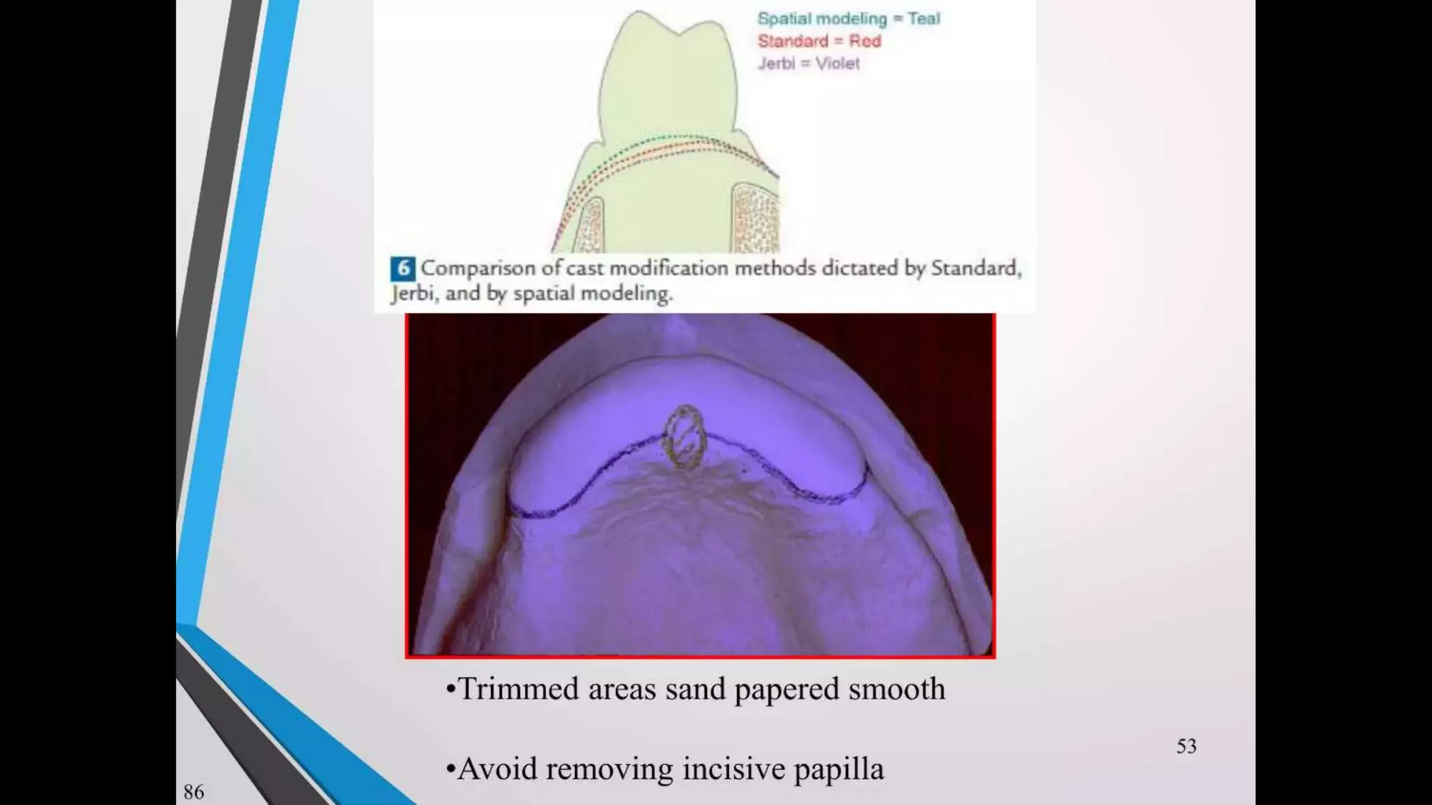 Immediate complete denture 05032023.pptx