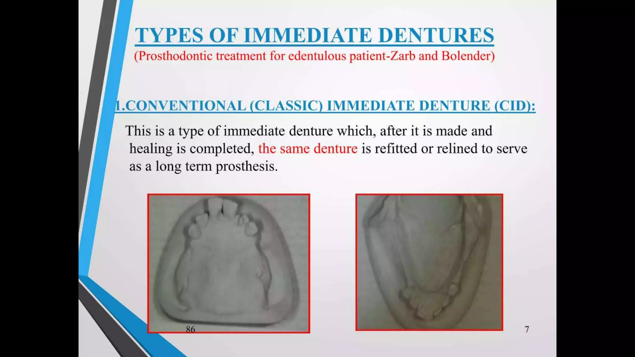 Immediate complete denture 05032023.pptx