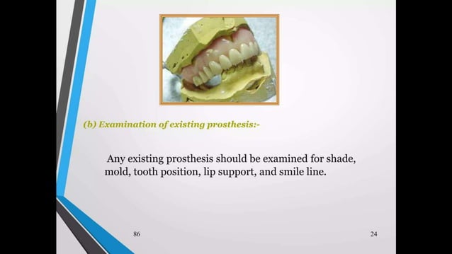 Immediate complete denture 05032023.pptx