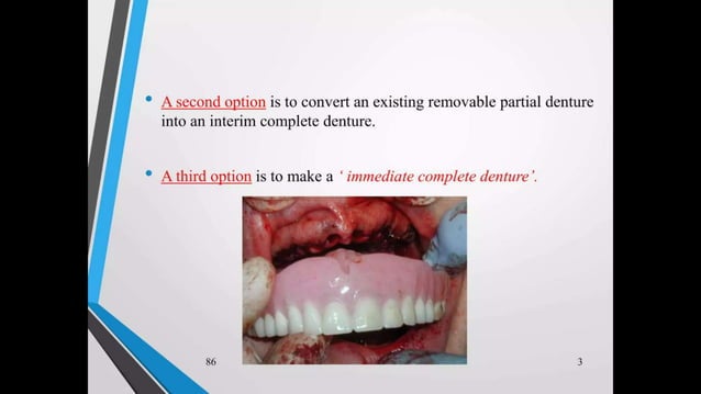 Immediate complete denture 05032023.pptx