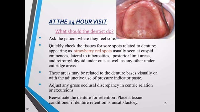 Immediate complete denture 05032023.pptx