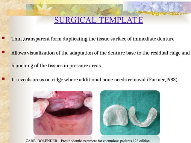 MANAGEMENT OF EDENTULOUS PATIENTS WITH IMMEDIATE COMPLETE DENTURES ...