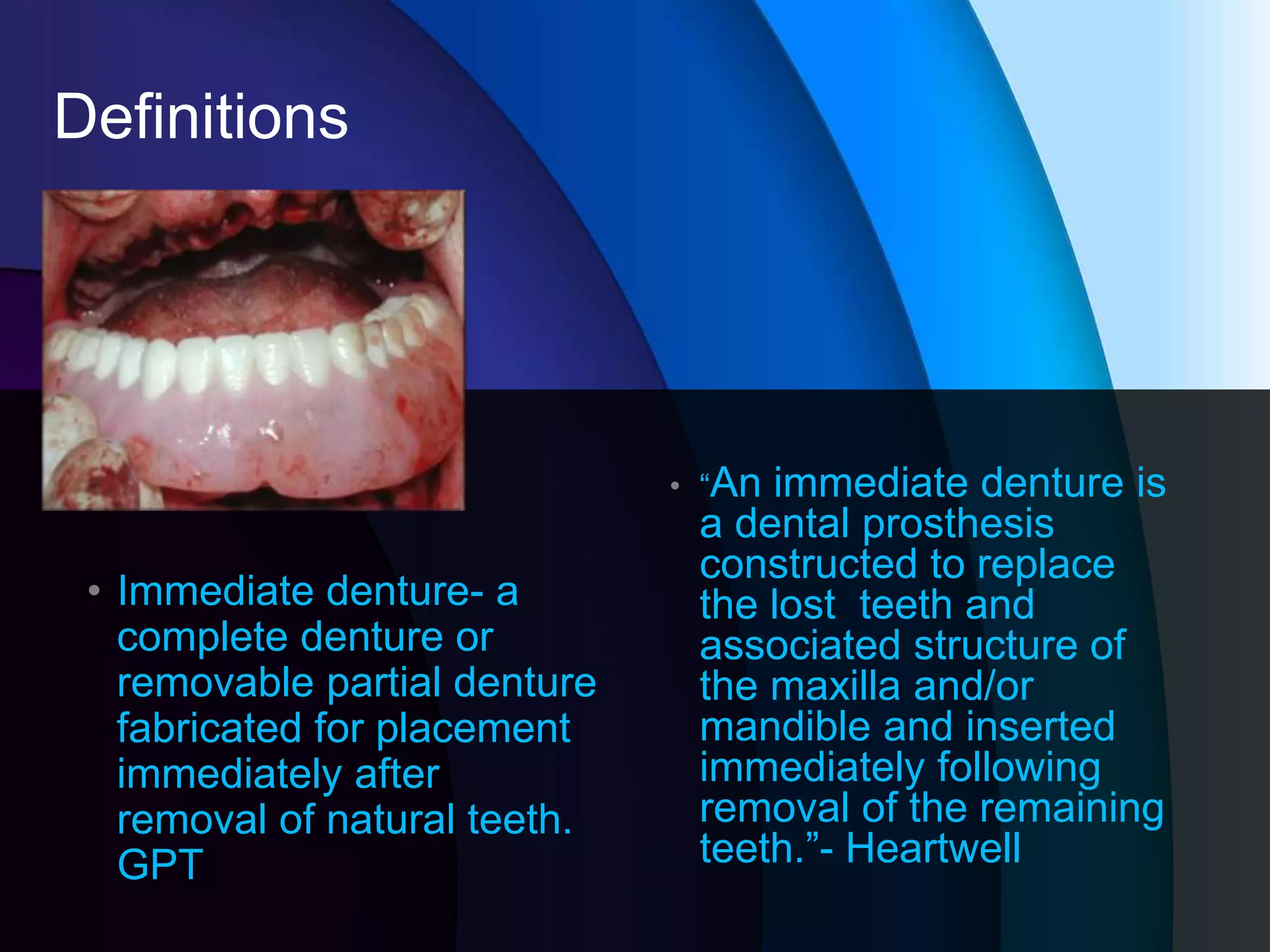 Immediate complete dentures | PPTX
