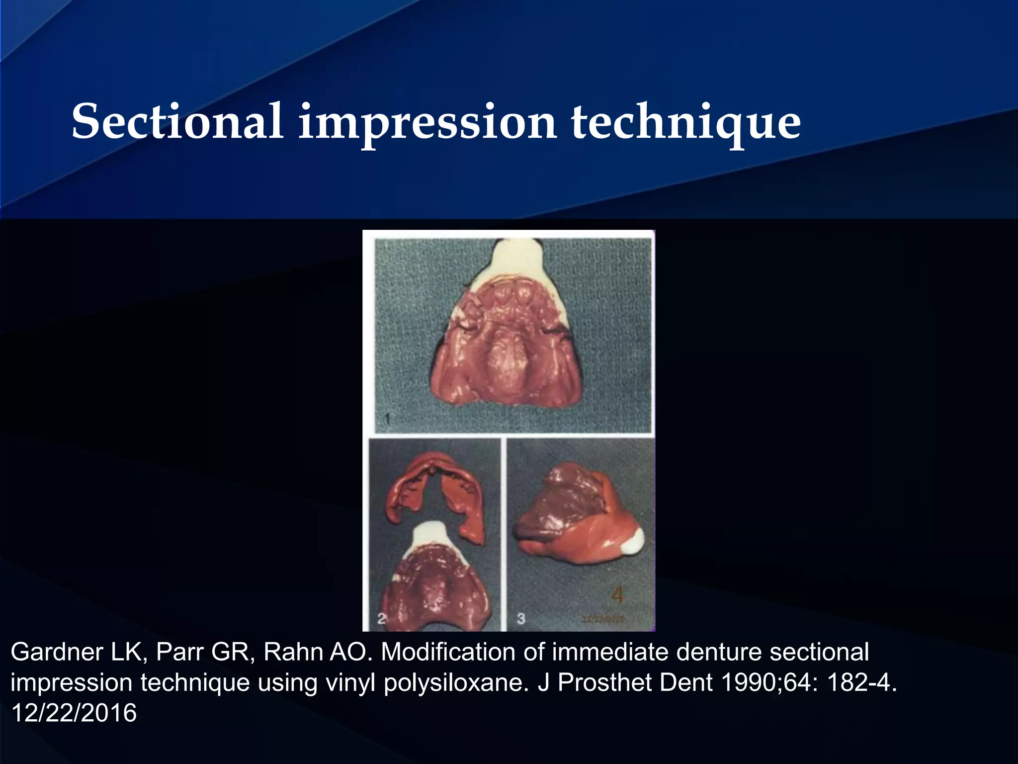 Immediate complete dentures | PPTX