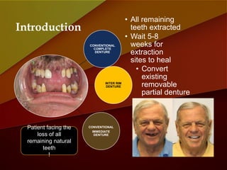 Immediate complete dentures | PPTX