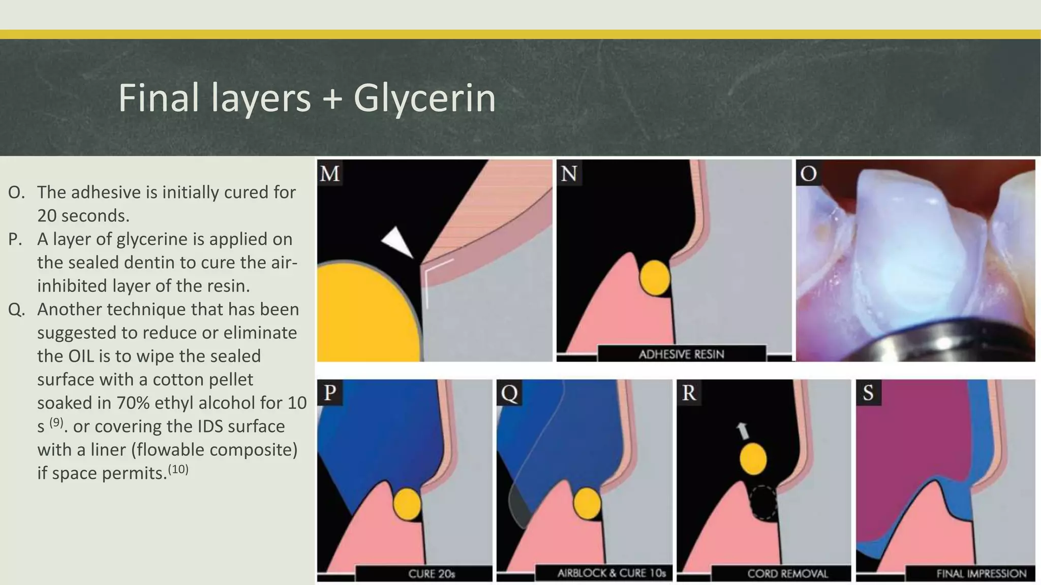 ImmediateDentinSealing.pptx