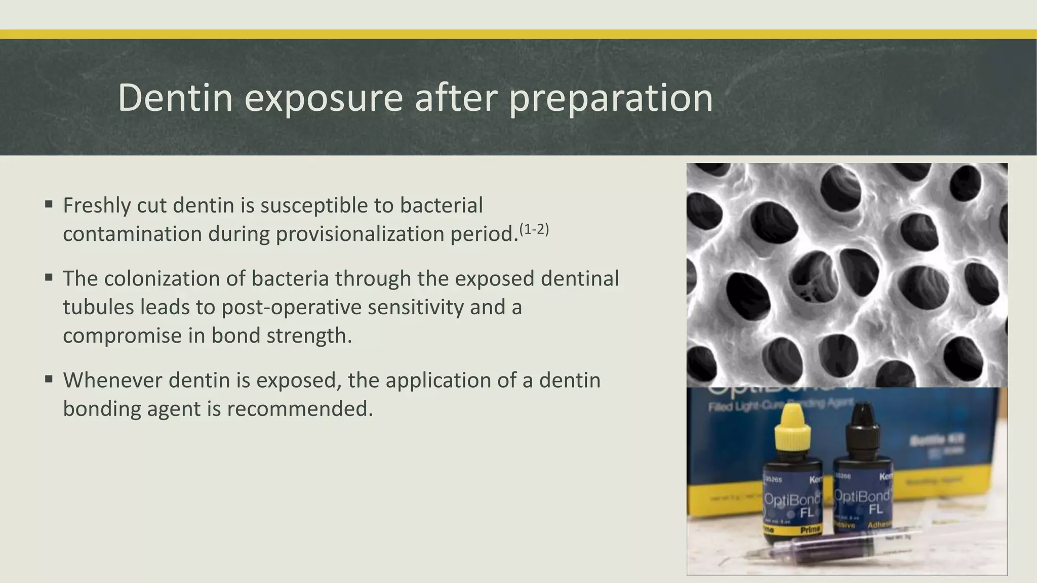 ImmediateDentinSealing.pptx