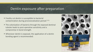 ImmediateDentinSealing.pptx