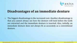 Immediate Denture | PPT
