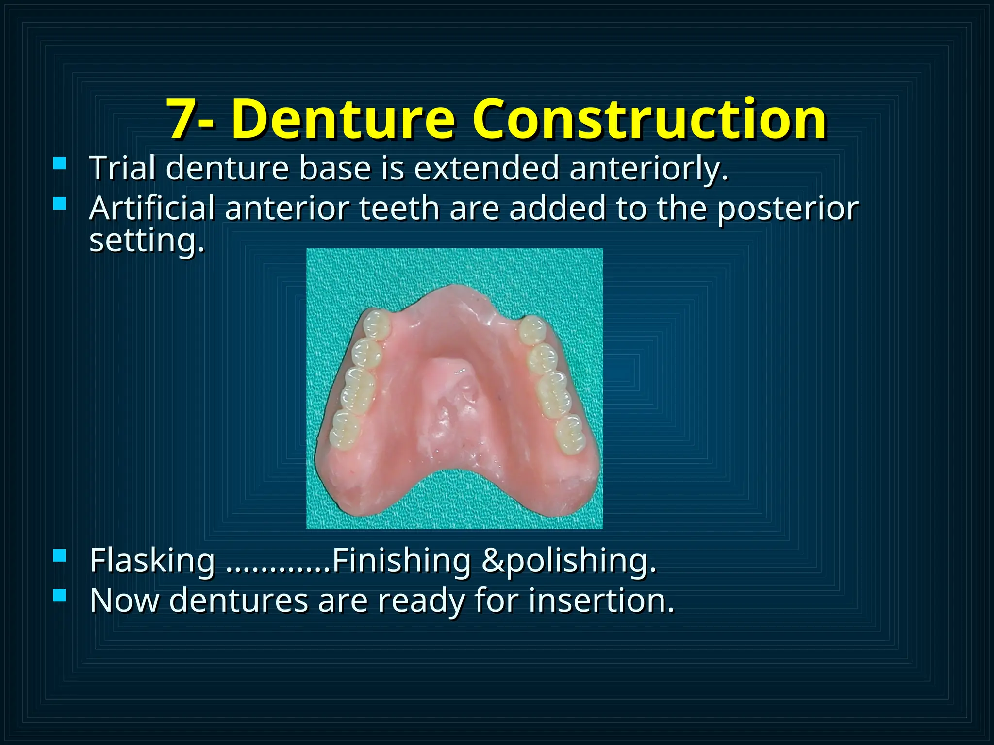 immediate denture part 1 modified (2024).ppt