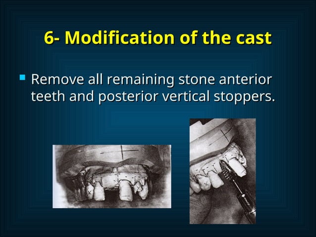 immediate denture part 1 modified (2024).ppt