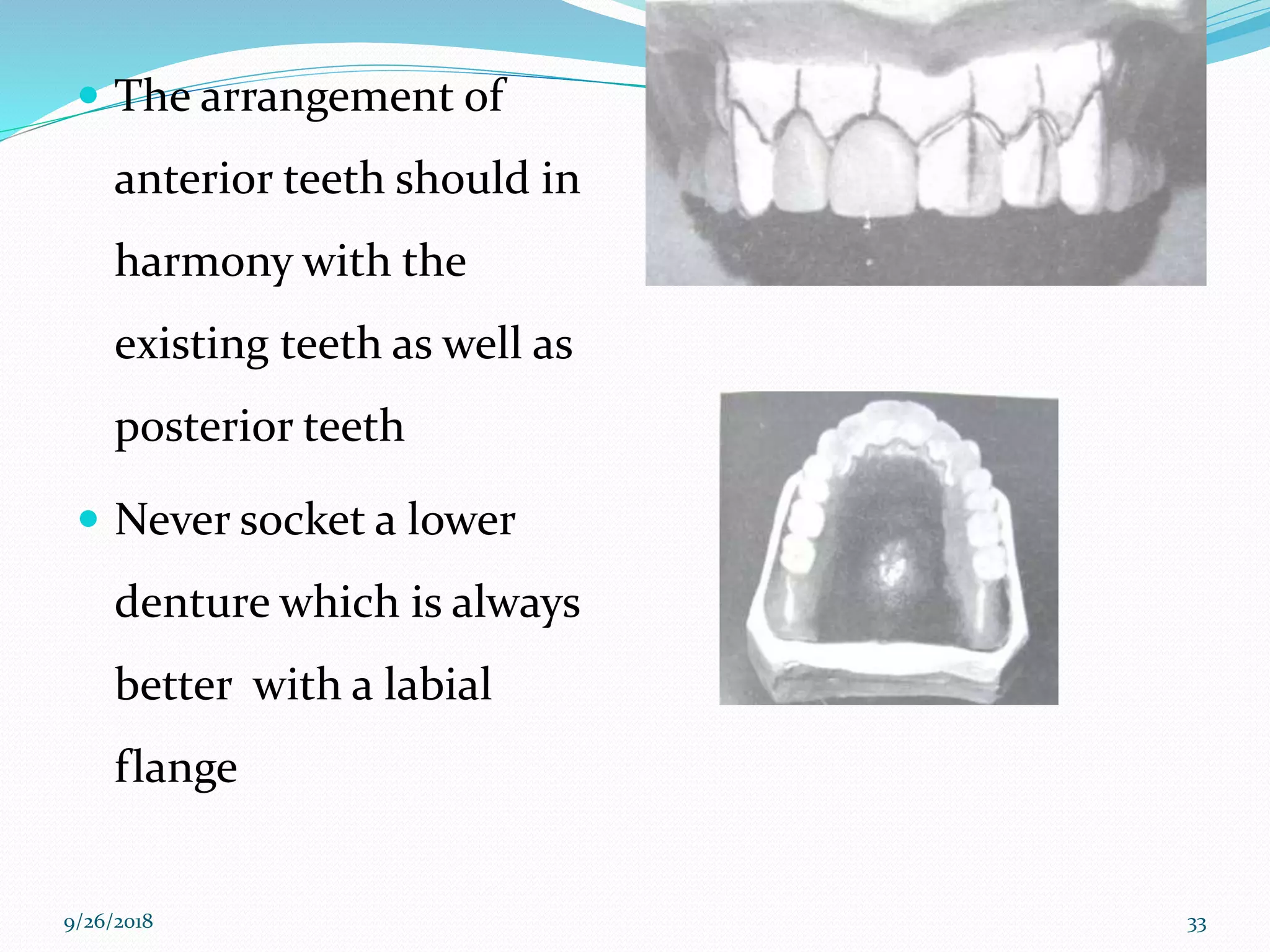 Immediate denture | PPTX