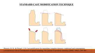 IMMEDIATE DENTURE power point presentation | PPTX
