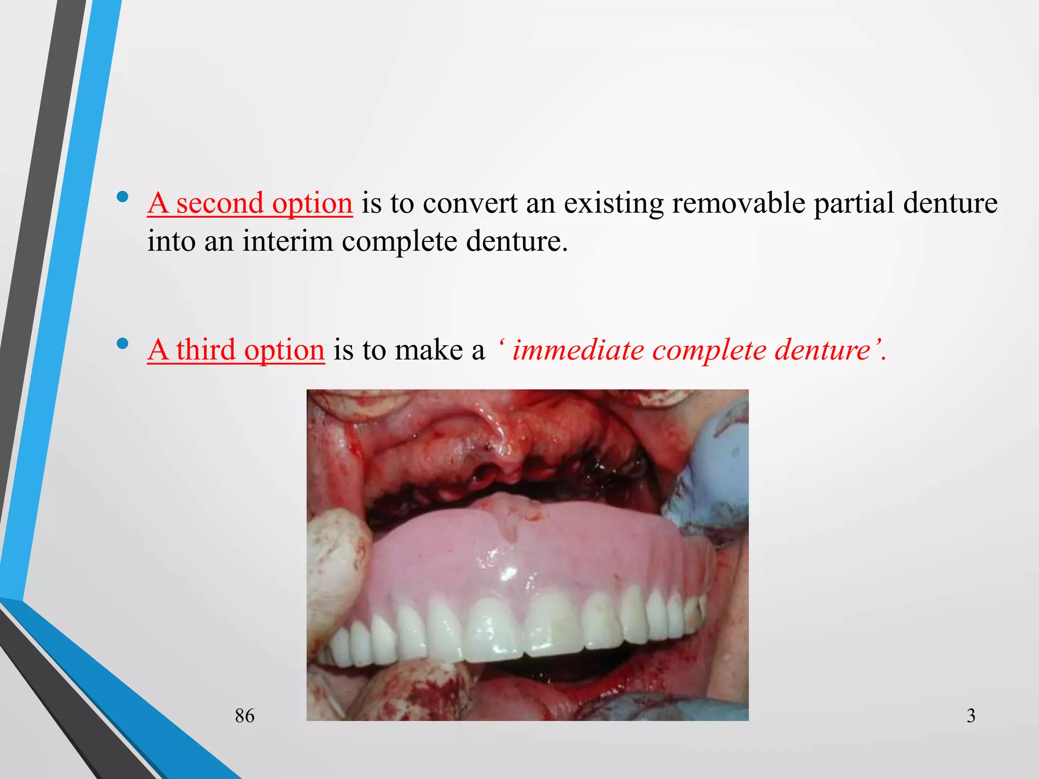 Immediate dentures | PPTX