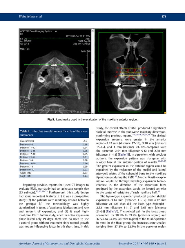 Immediate effects of rapid maxillary expansion with haas-type and hyrax ...