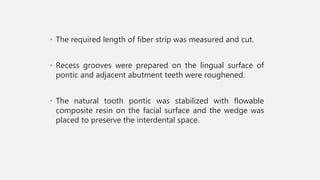 Immediate esthetic rehabilitation of periodontally compromised anterior ...