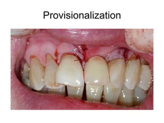 Immediate extraction ridge graft and implant placement | PPT | Dental ...
